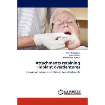 Attachments Retaining Implant Overdentures