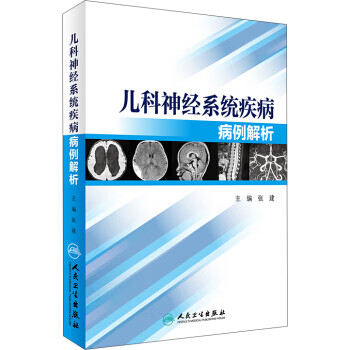 儿科神经系统疾病病例解析【正版图书】