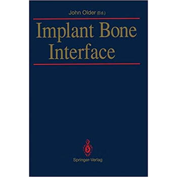 Implant Bone Interface