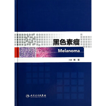 黑色素瘤(精)