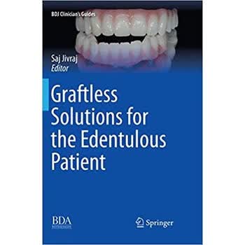 Graftless Solutions for the Edentulous Patient