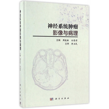 神经系统肿瘤影像与病理(精)