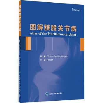 图解髌股关节病
