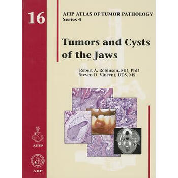 Tumors and Cysts of the Jaws