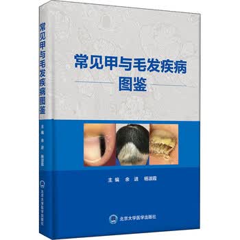 常见甲与毛发疾病图鉴 余进,杨淑霞 编 皮肤病学与性病学 WX