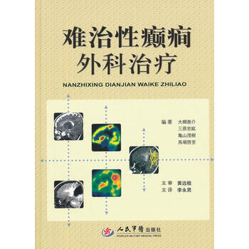 难治性癫痫外科治疗