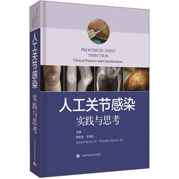 人工关节感染:实践与思考