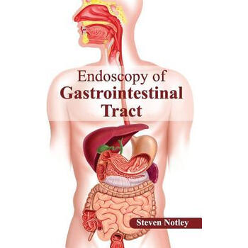 Endoscopy of Gastrointestinal Tract