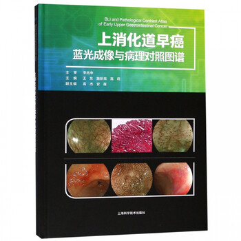 上消化道早癌蓝光成像与病理对照图谱(精)