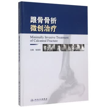 跟骨骨折微创治疗(精)
