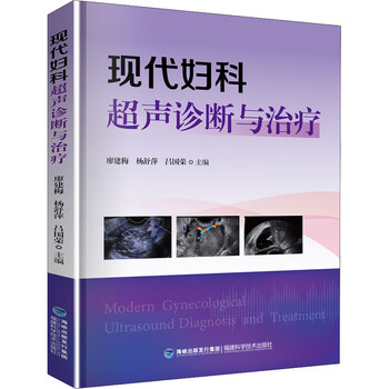 现代妇科超声诊断与治疗
