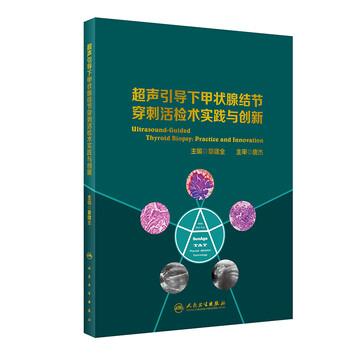 超声引导下甲状腺结节穿刺活检术实践与创新
