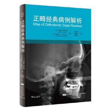 正畸经典病例解析【正版图书】