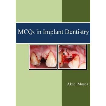 MCQs in Implant Dentistry