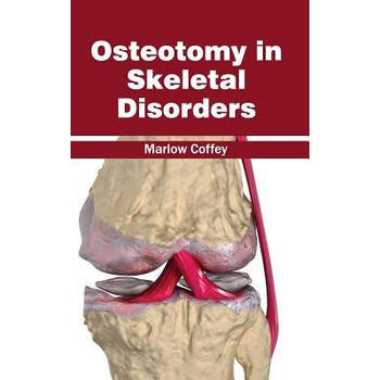 Osteotomy in Skeletal Disorders