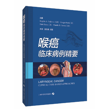 喉癌：临床病例精要