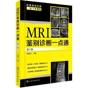 MRI鉴别诊断一点通(第3版) 范国光 主编 书籍