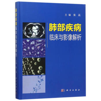 肺部疾病临床与影像解析 编者:张嵩 作 书籍