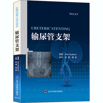 输尿管支架