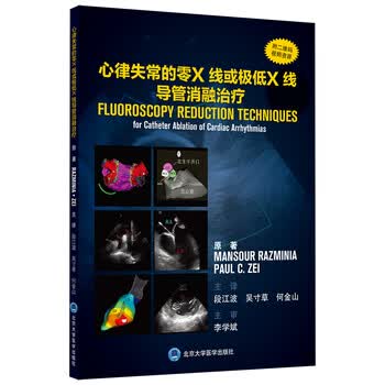 心律失常的零X线或极低X线导管消融治疗