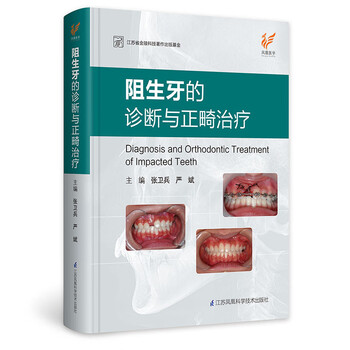 阻生牙的诊断与正畸治疗(精)