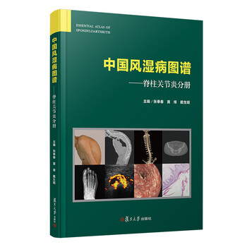 中国风湿病图谱 脊柱关节炎分册  复旦大学出版社