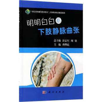 明明白白看下肢静脉曲张