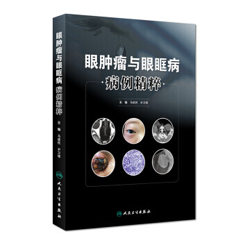 眼肿瘤与眼眶病病例精粹【正版图书】