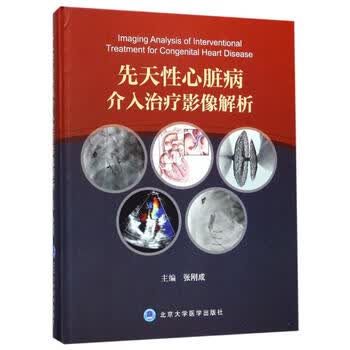 先天性心脏病介入治疗影像解析
