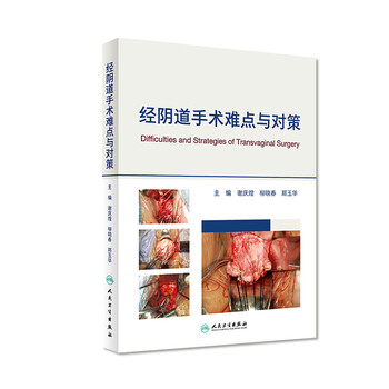 经阴道手术难点与对策