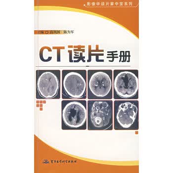 CT读片手册－影像学读片掌中宝系列