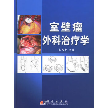 室壁瘤外科治疗学