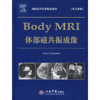 体部磁共振成像