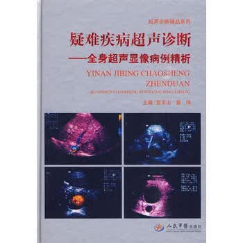 包邮：疑难疾病超声诊断-全身超声显病例精析医学疑难病超声波诊断病案分析 图书