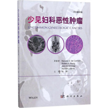 少见妇科恶性肿瘤 