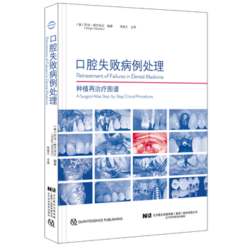 口腔失败病例处理