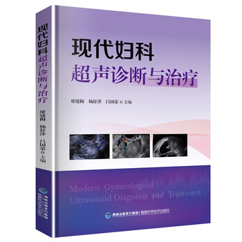 现代妇科超声诊断与治疗
