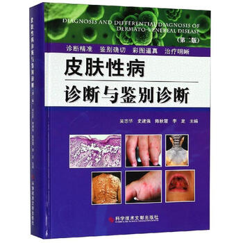 皮肤性病诊断与鉴别诊断(第2版) 吴志华 史建强 陈秋霞 李定  书籍