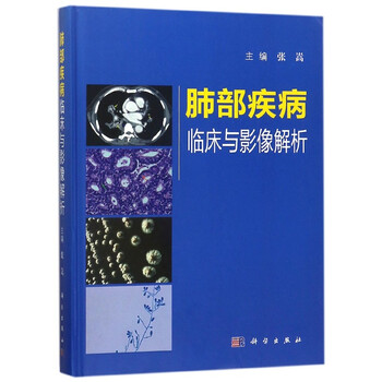 肺部疾病临床与影像解析(精)
