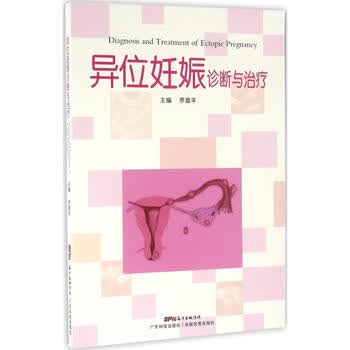 异位妊娠诊断与治疗