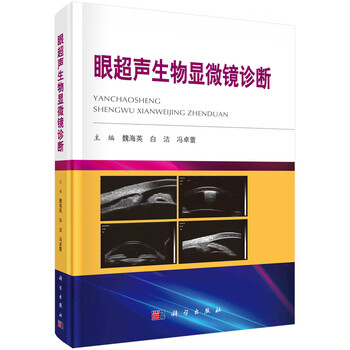 眼超声生物显微镜诊断/魏海英,白洁,冯卓蕾