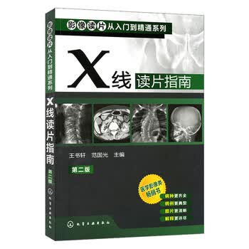 影像读片从入门到精通系列--X线读片指南(第二版)