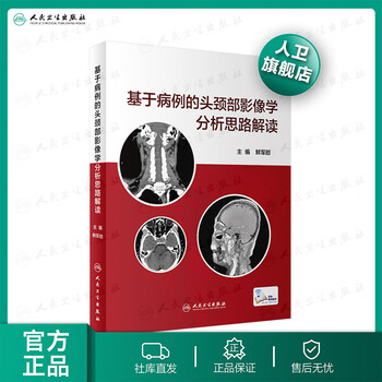 基于病例的头颈部影像学分析思路解读