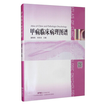 甲病临床病例图谱