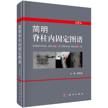 简明脊柱内固定图谱