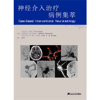 神经介入治疗病例集萃