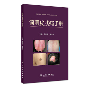 简明皮肤病手册【正版图书】
