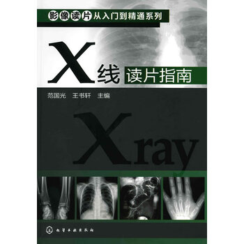 X线读片指南货
