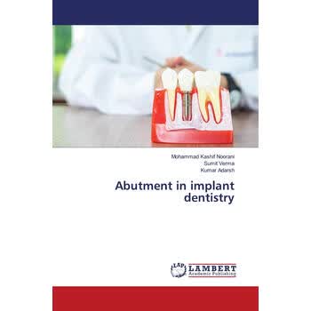 Abutment in implant dentistry