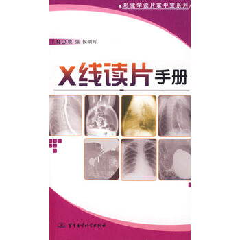 X线读片手册—影像学读片掌中宝系列
